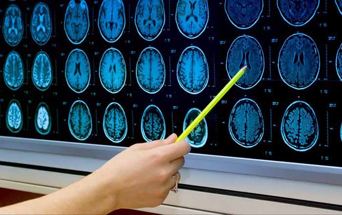 Addictive ‘Brain Hijacking’ Methods of Social Media Platforms Harmful ...