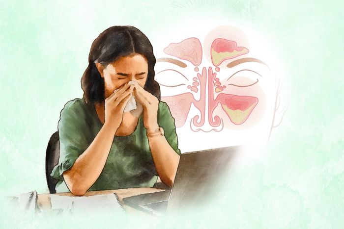 Sinus Infection: Symptoms, Causes, Treatments - USNN World News